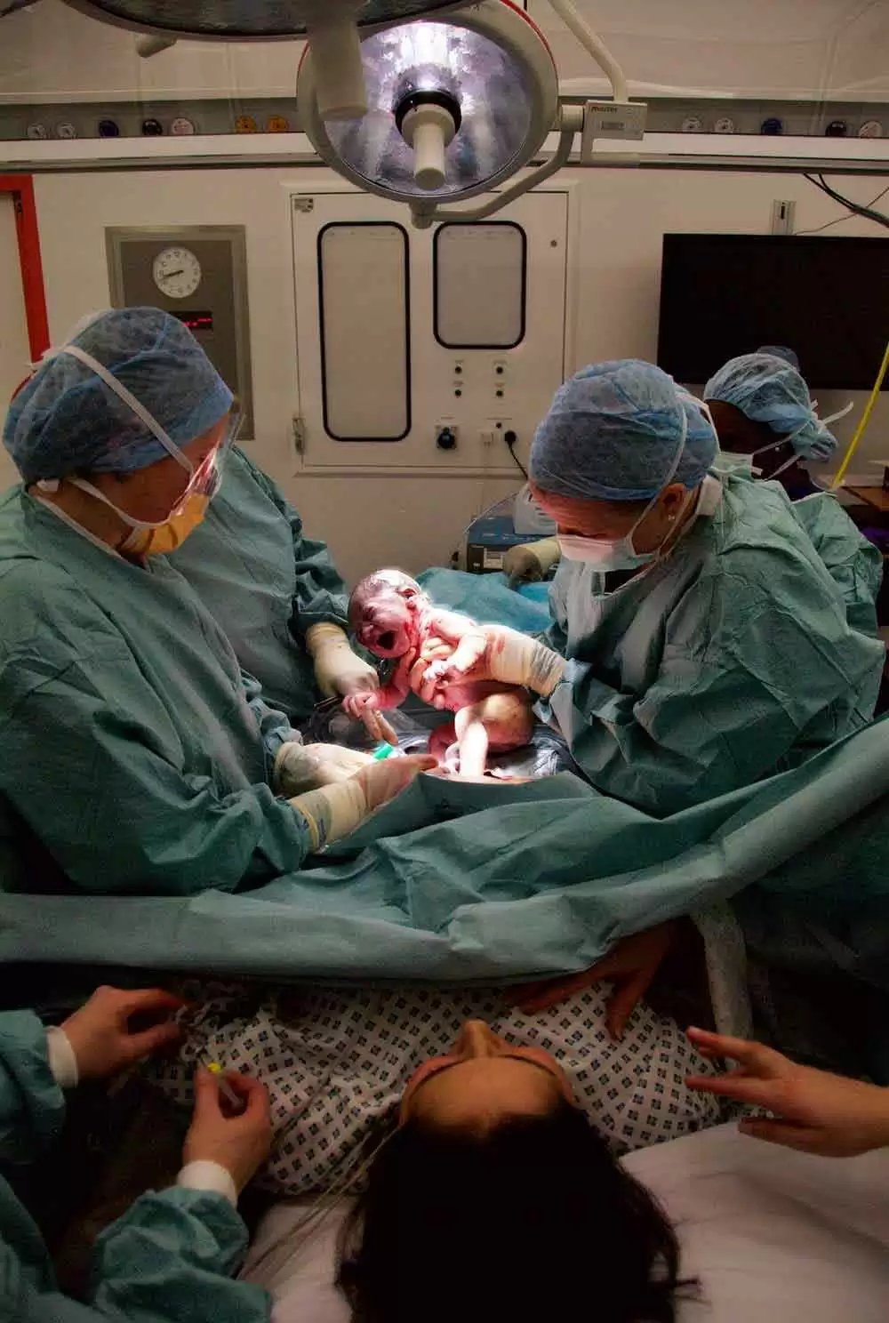 Does How You Are Born Influence Your Odds of Developing Celiac Disease ...